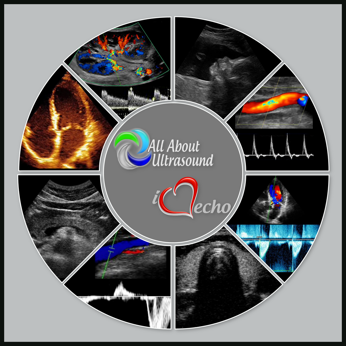 Anatomical Heart Collection – All About Ultrasound